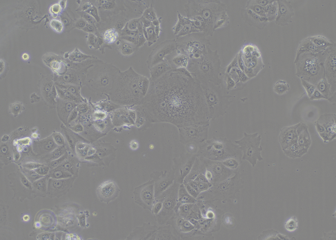 Tips for Quickly Master MCF7 Cell Culture and Gene Editing | Ubigene