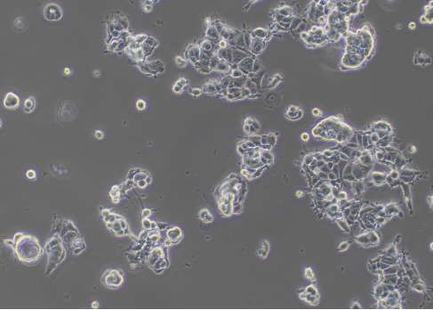 Tips for Quickly Master MCF7 Cell Culture and Gene Editing | Ubigene